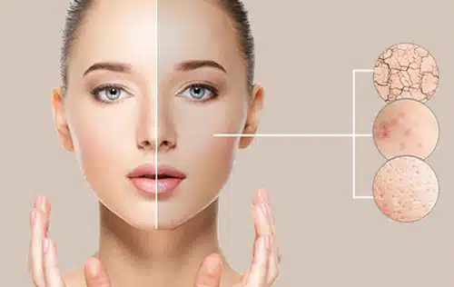 Hyaluronik Asit Serum | Hyaluronik Asit